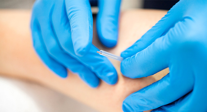 TrP Dry Needling (Η μέθοδος της ξηράς βελόνας) – Level 1. - Edu ...